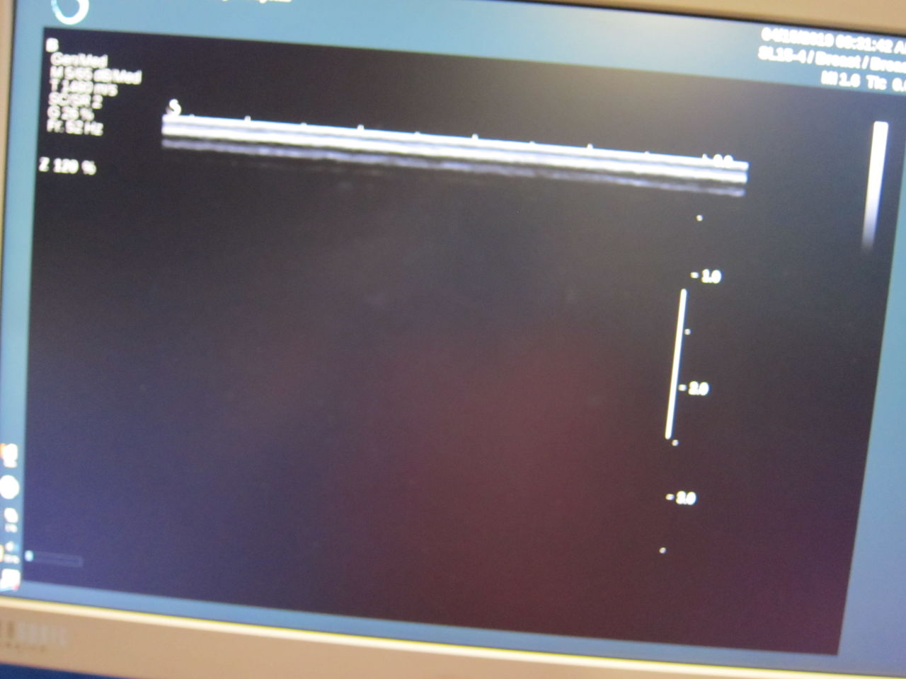 AixPlorer Multiwave Ultrasound General Auction